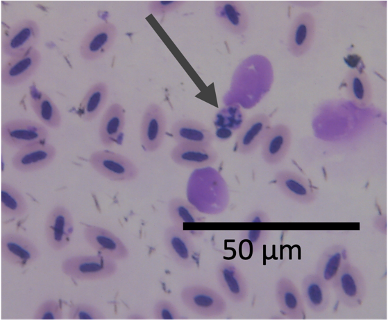 Avian malaria in a red blood cell - Wisconsin Waterfowl Association